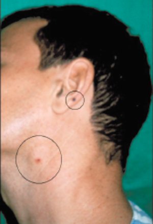 El Universal - Sociedad - Revisar el ABCD de los lunares